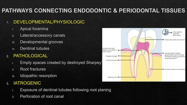 ENDO-PERIO LESIONS | PPTX | Dental Health | Diseases and Conditions