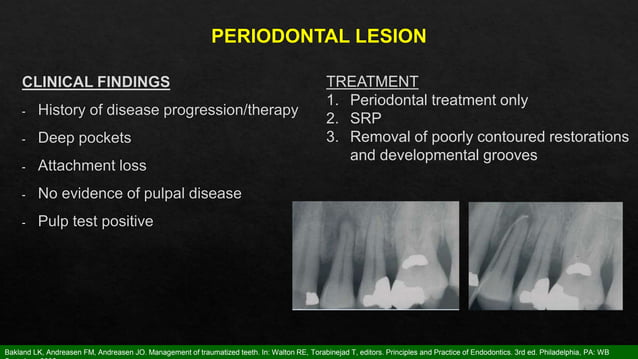 ENDO-PERIO LESIONS