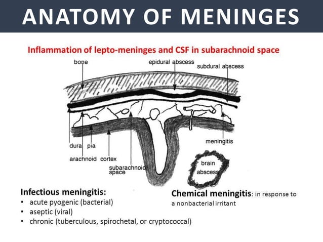 Management of Meningitis | PPTX | Brain and Nervous System Disorders ...