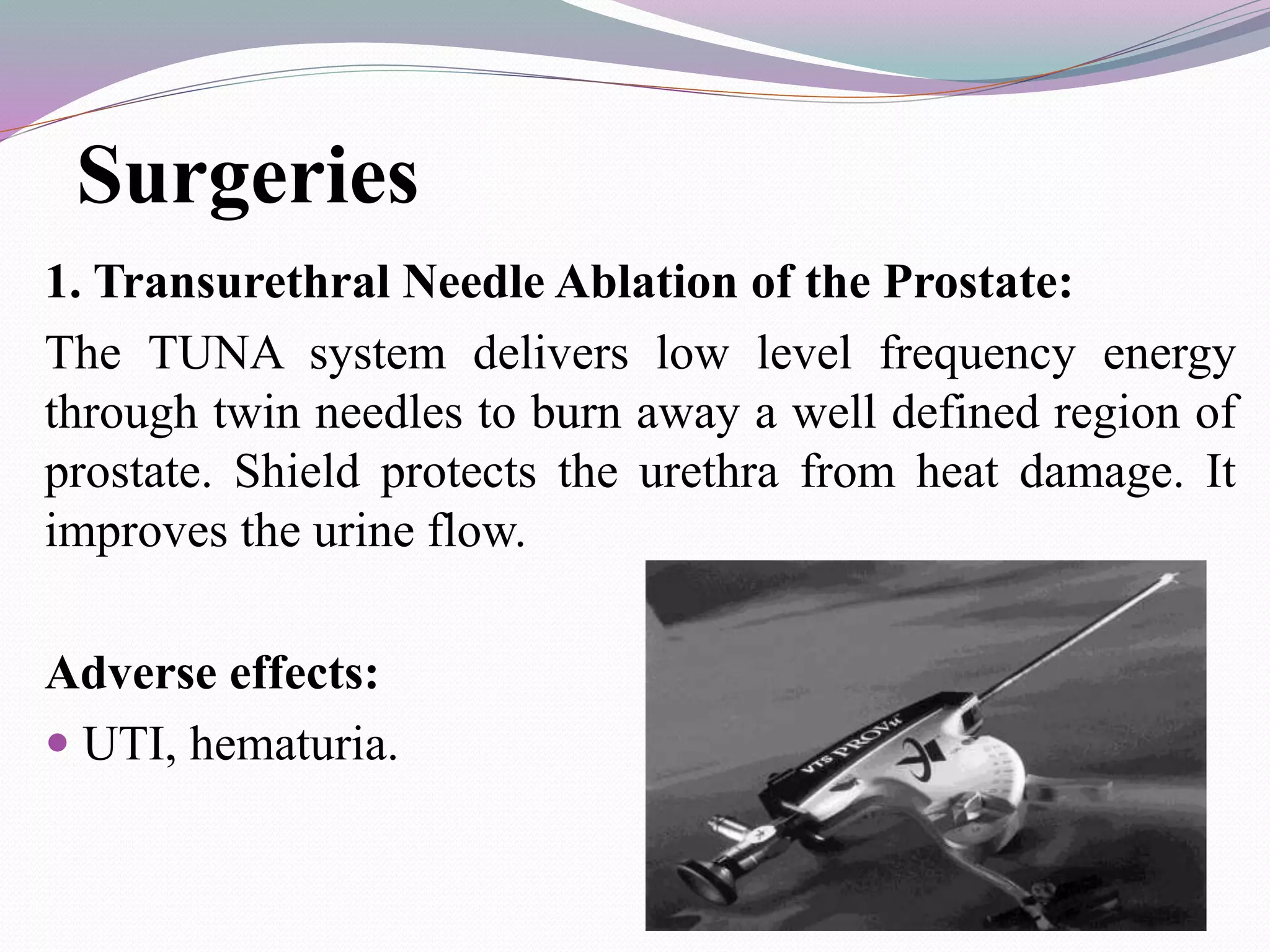 Benign Prostate Hypertrophy | PPTX