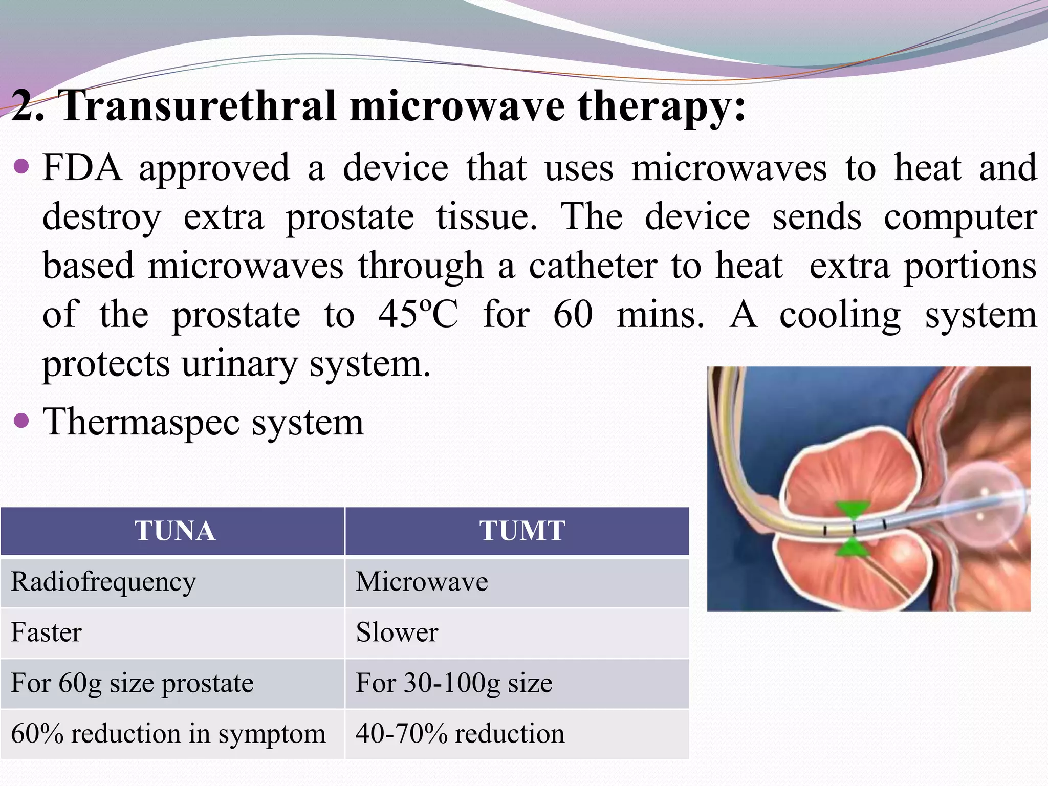 Benign Prostate Hypertrophy | PPTX