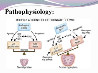 Benign Prostate Hypertrophy | PPTX
