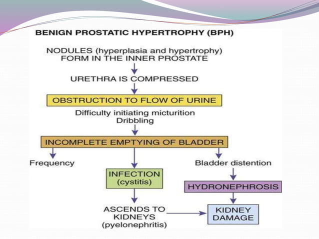 Benign Prostate Hypertrophy | PPTX