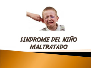 17 SINDROME DEL NIÑO MALTRATADO.ppt SINDROME DEL NIÑO MALTRATADO ...