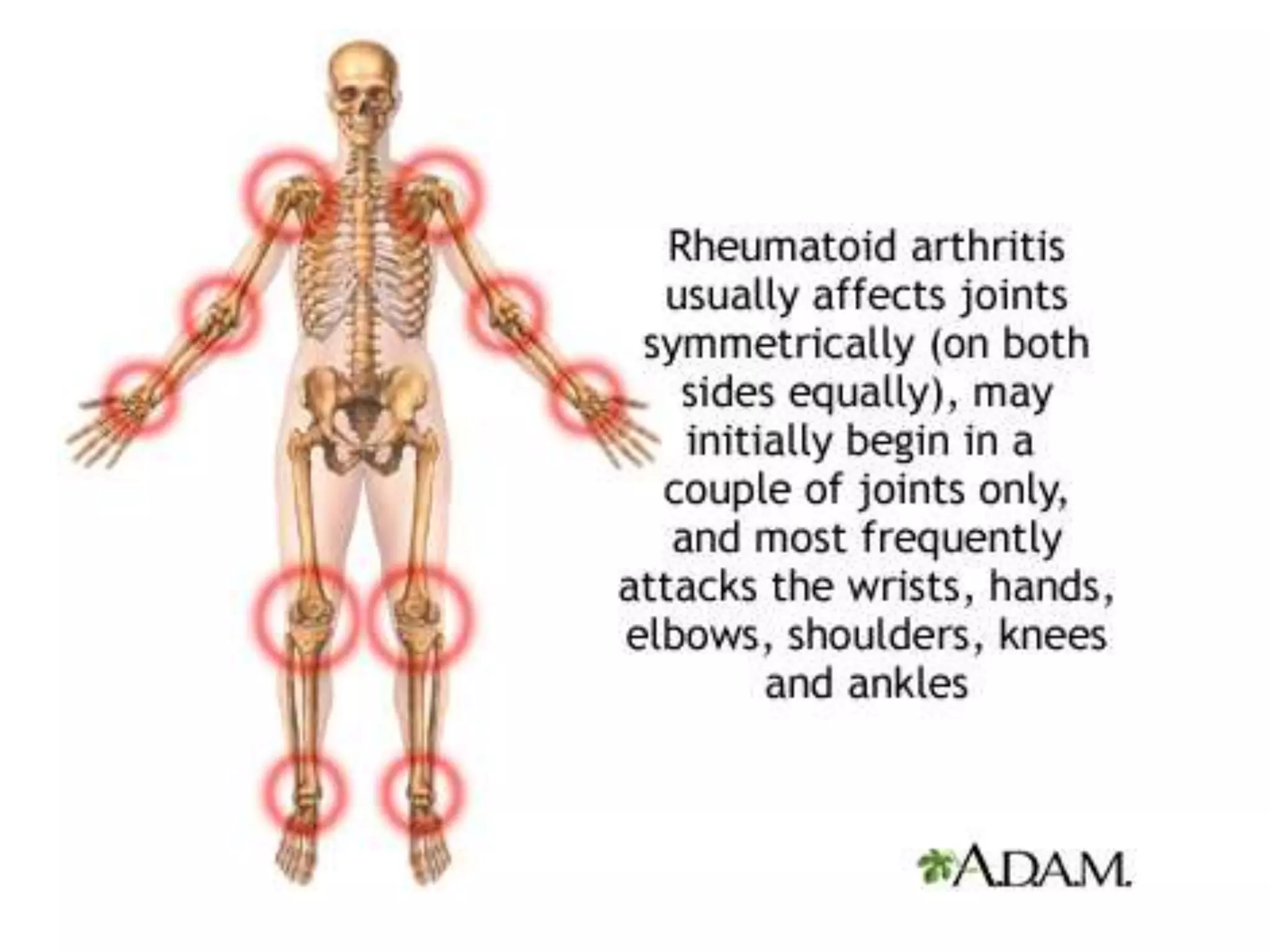Primary care approach to joint pain | PPTX