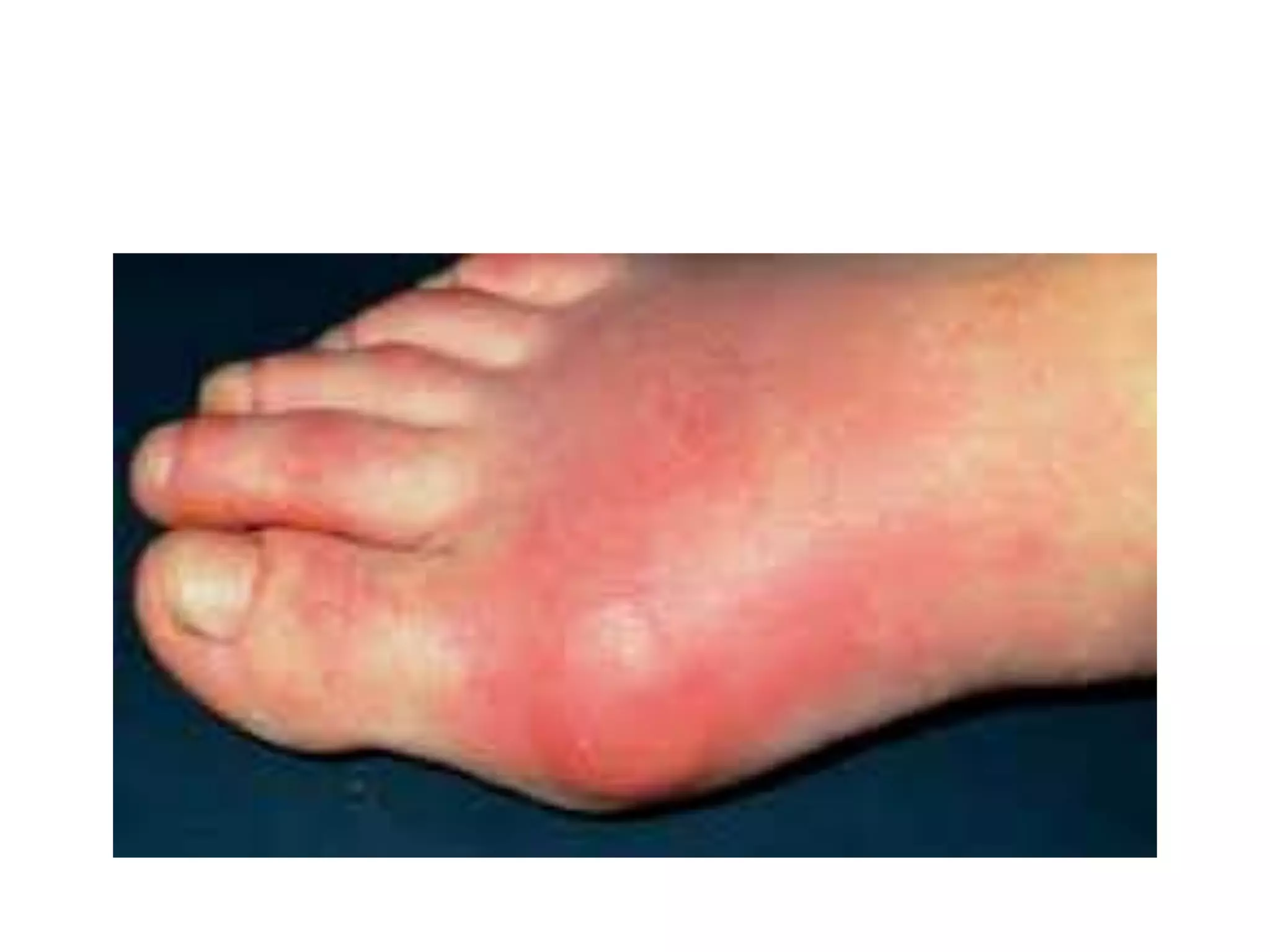 Primary care approach to joint pain | PPTX