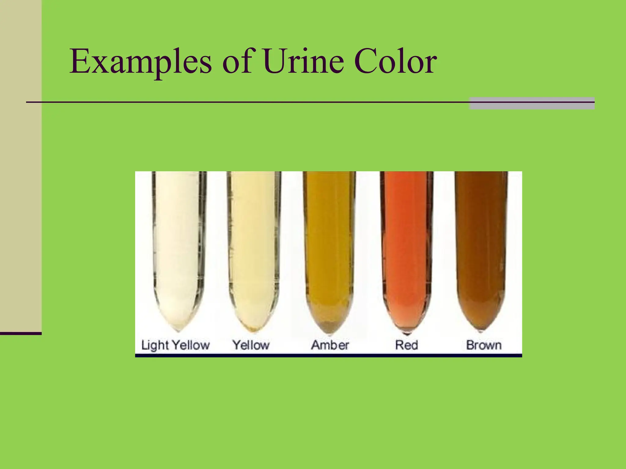 urine_analysis -urine _ analysis.pptx