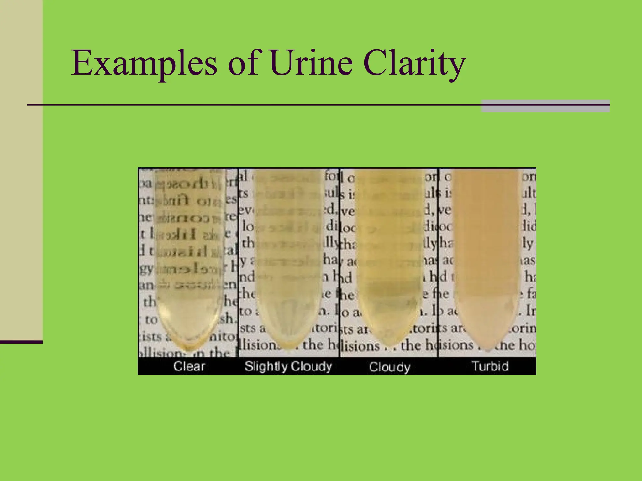 urine_analysis -urine _ analysis.pptx