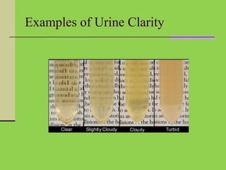 urine_analysis -urine _ analysis.pptx