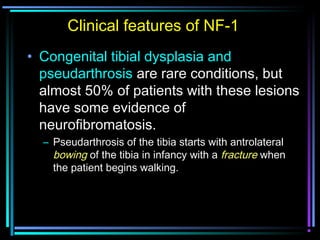 18. neurofibromatosis muhammad abdelghani | PPT