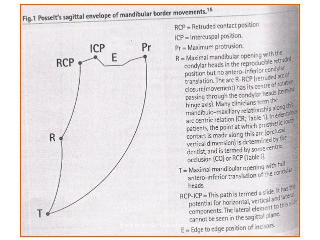 Recording the rcp a review of clinical techniques /orthodontic therap…