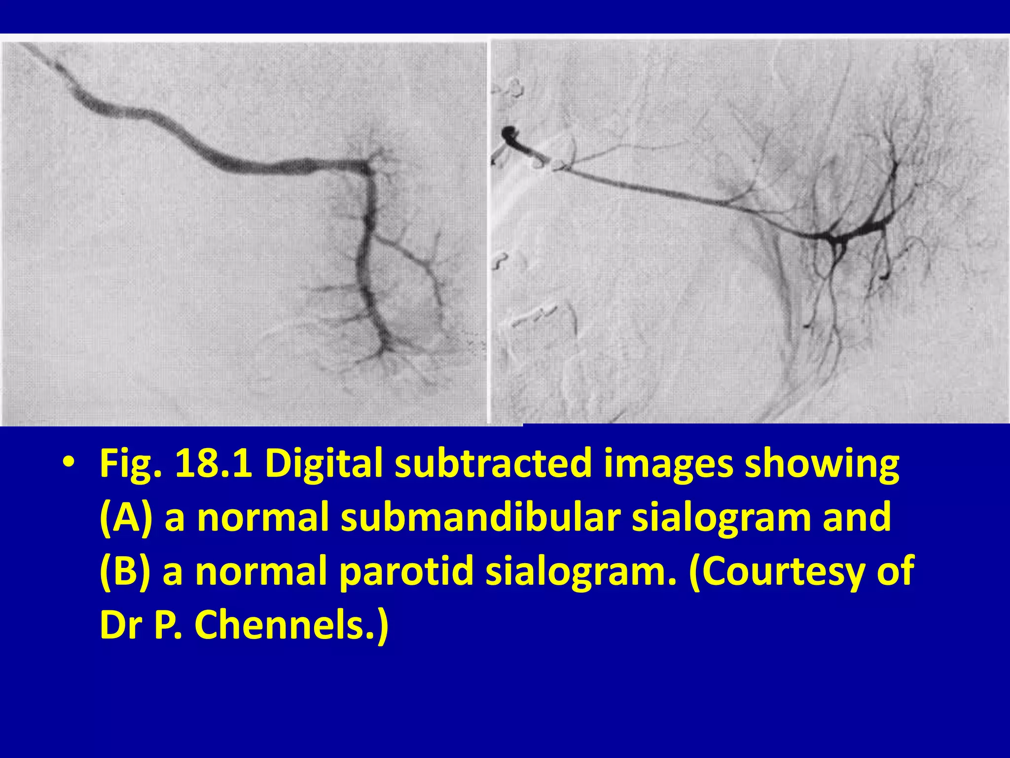 18 DAVID SUTTON PICTURES THE SALIVARY GLANDS PHARYNX AND ESOPHAGUS | PPTX