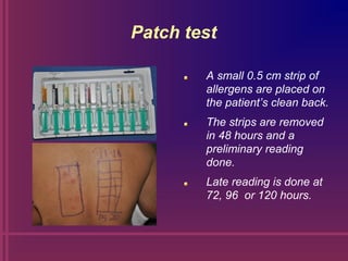 18Occupational Skin diseases and management, Dr. Dincy peter | PDF