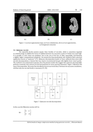 Hybrid medical image compression method using quincunx wavelet and geometric actif contour | PDF