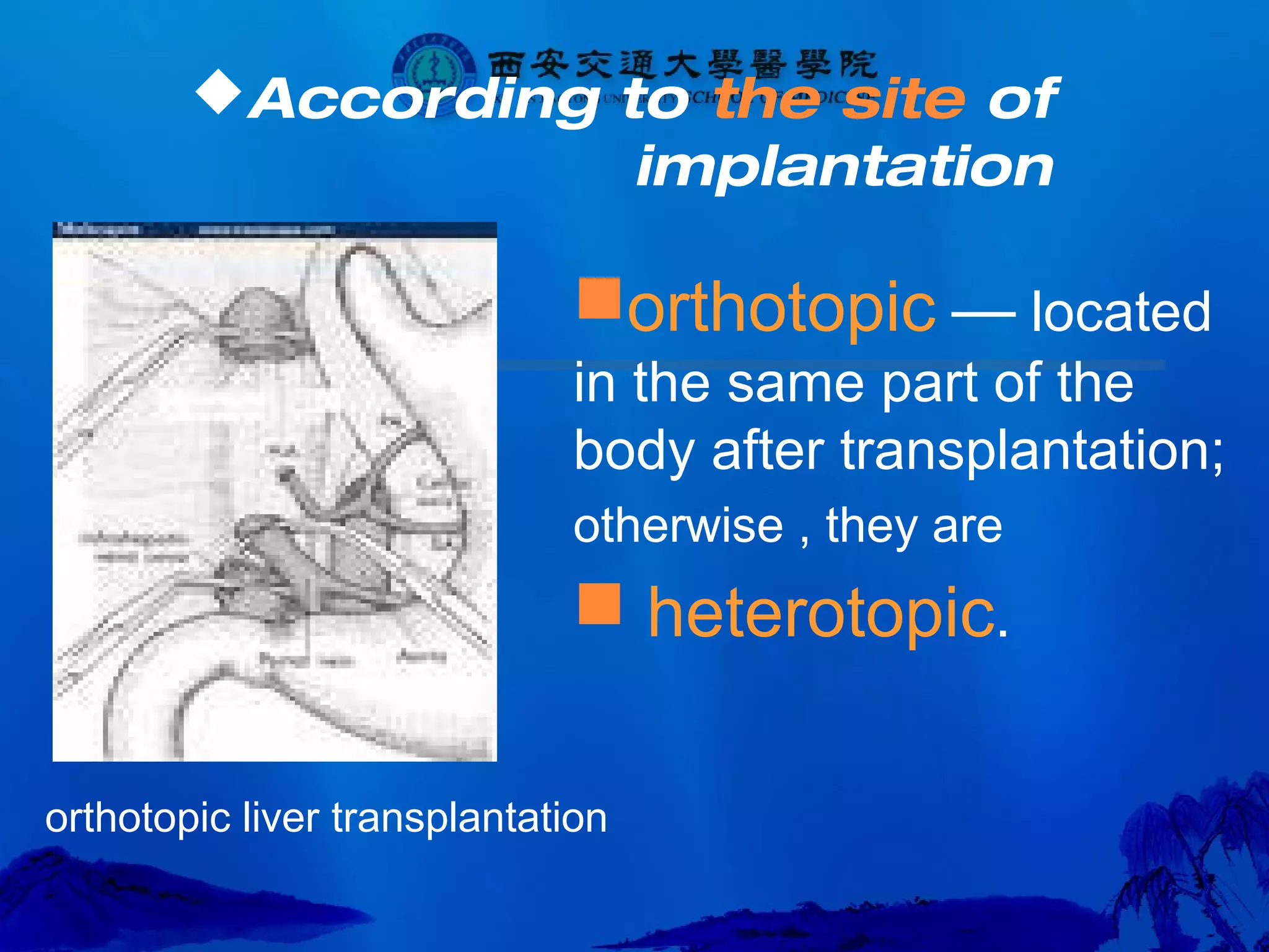Transplantation | PPT