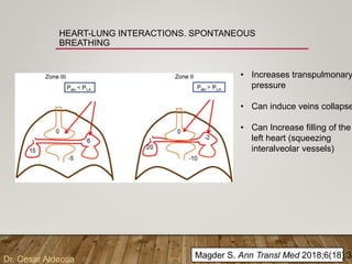 18. #ifad2019 heart lung interactions (aldecoa) | PPTX