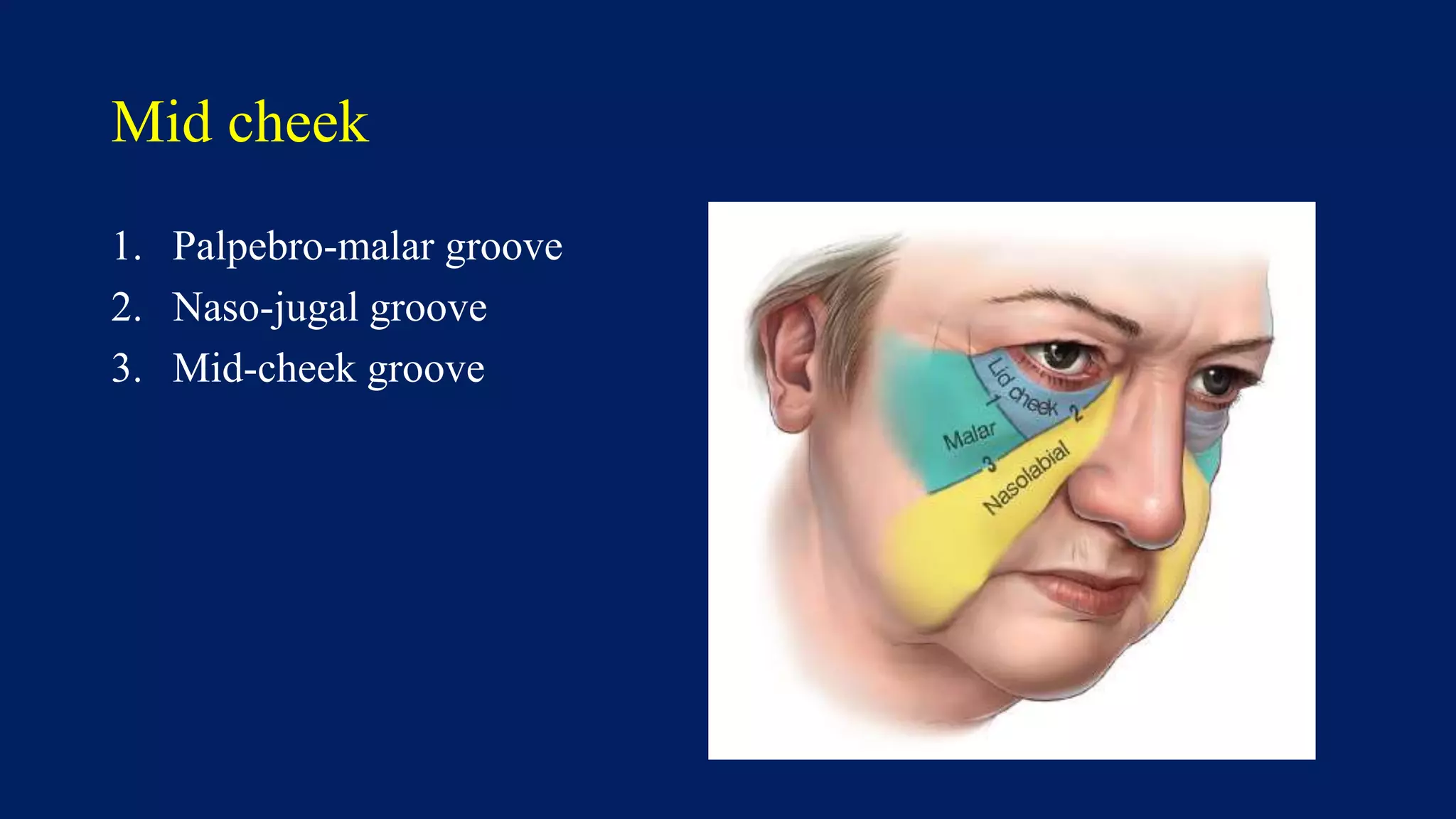 Face lift - Rhytidectomy | PPTX