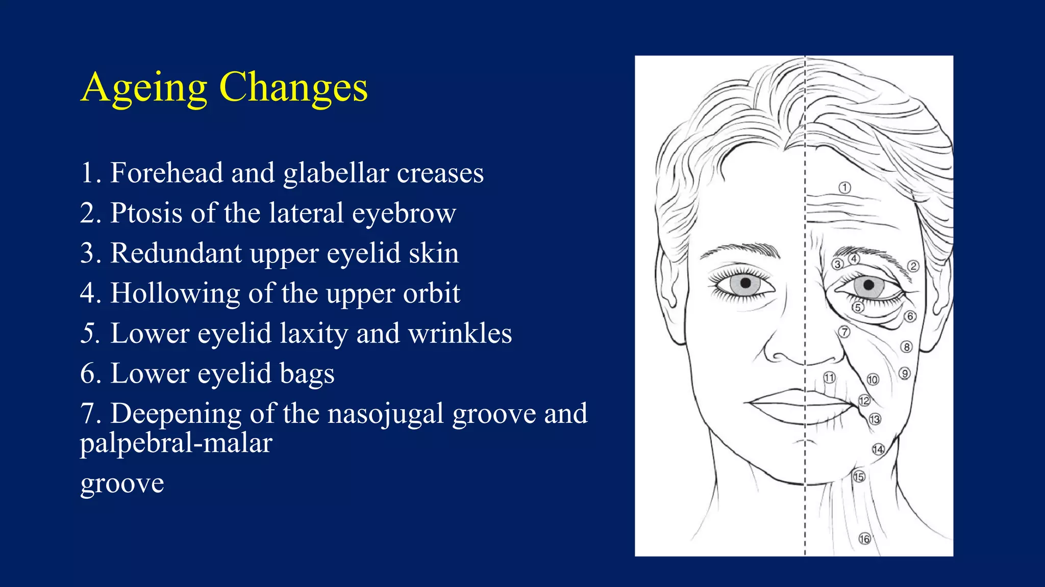 Face lift - Rhytidectomy | PPTX