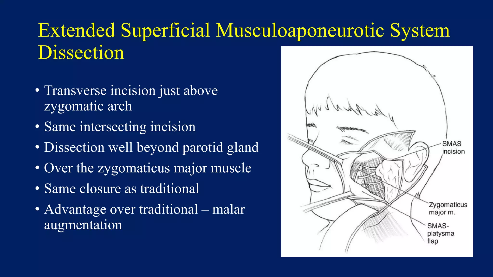 Face lift - Rhytidectomy | PPTX