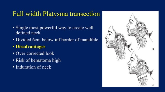 Face lift - Rhytidectomy | PPT