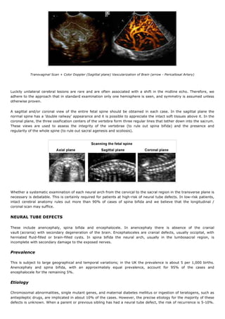 18-23_Weeks_Scan ultrsasound scan in medecine.pdf