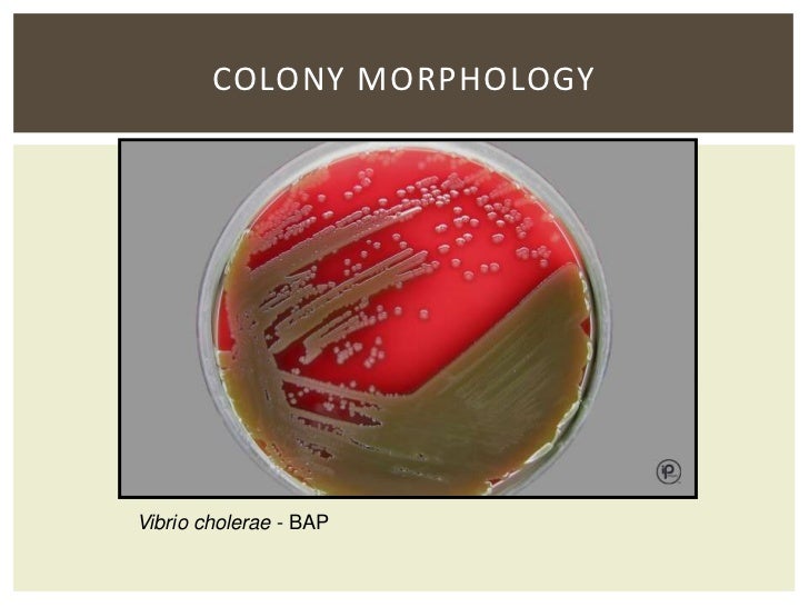 18 -chapter_20_-_curved_gnb