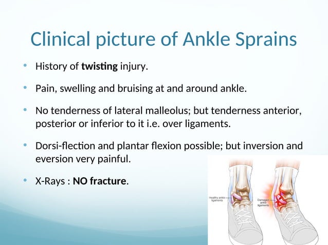 18-Common foot and ankle disorders orthopaedics.ppt