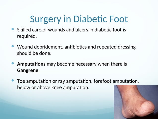18-Common foot and ankle disorders orthopaedics.ppt