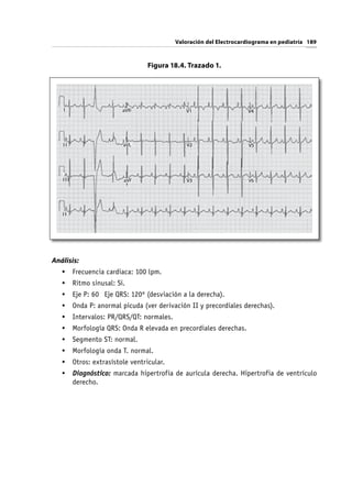 18 electrocardiograma | PDF