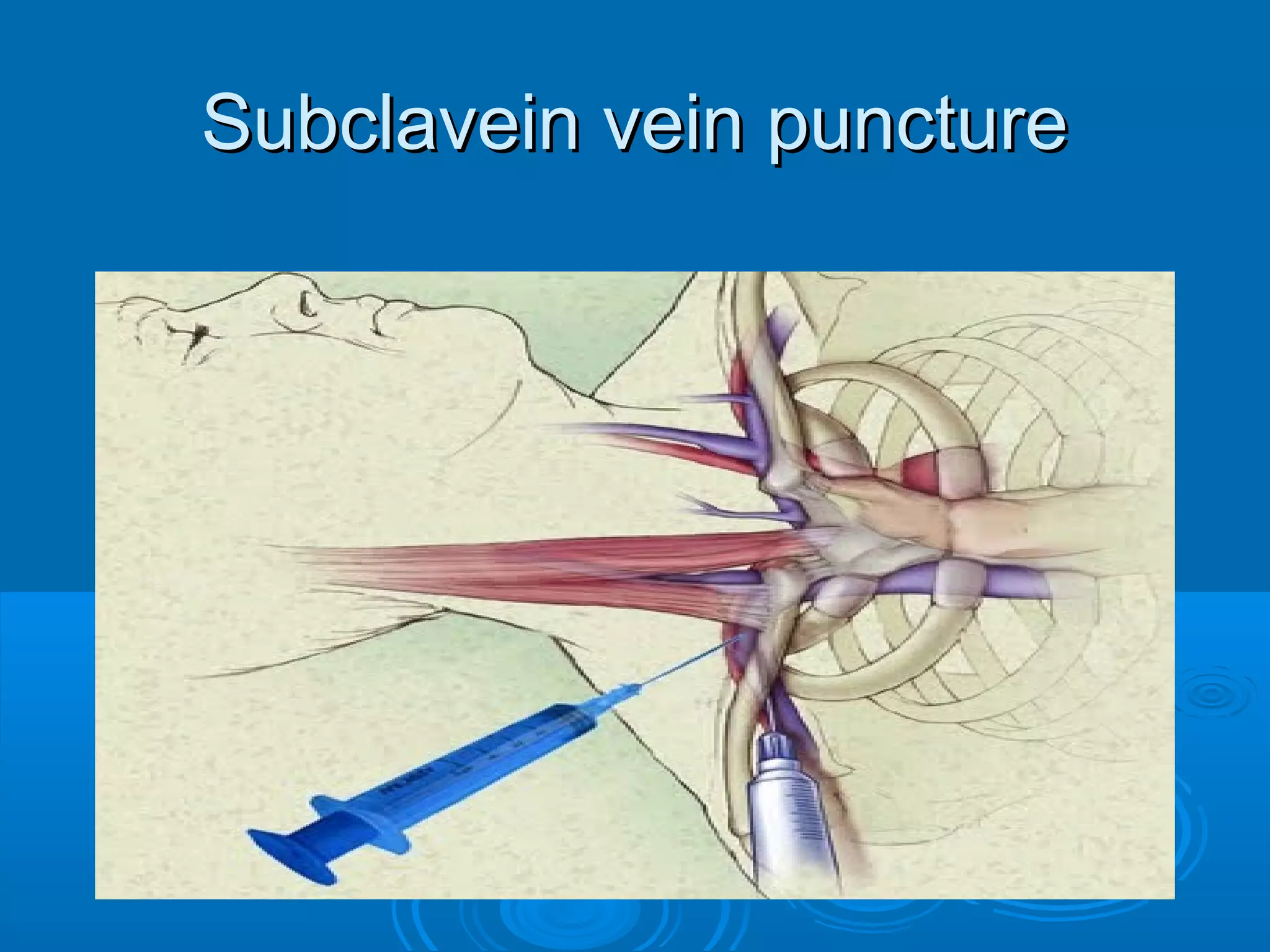 18 main arteries & veins of neck for anaesthesia | PPT
