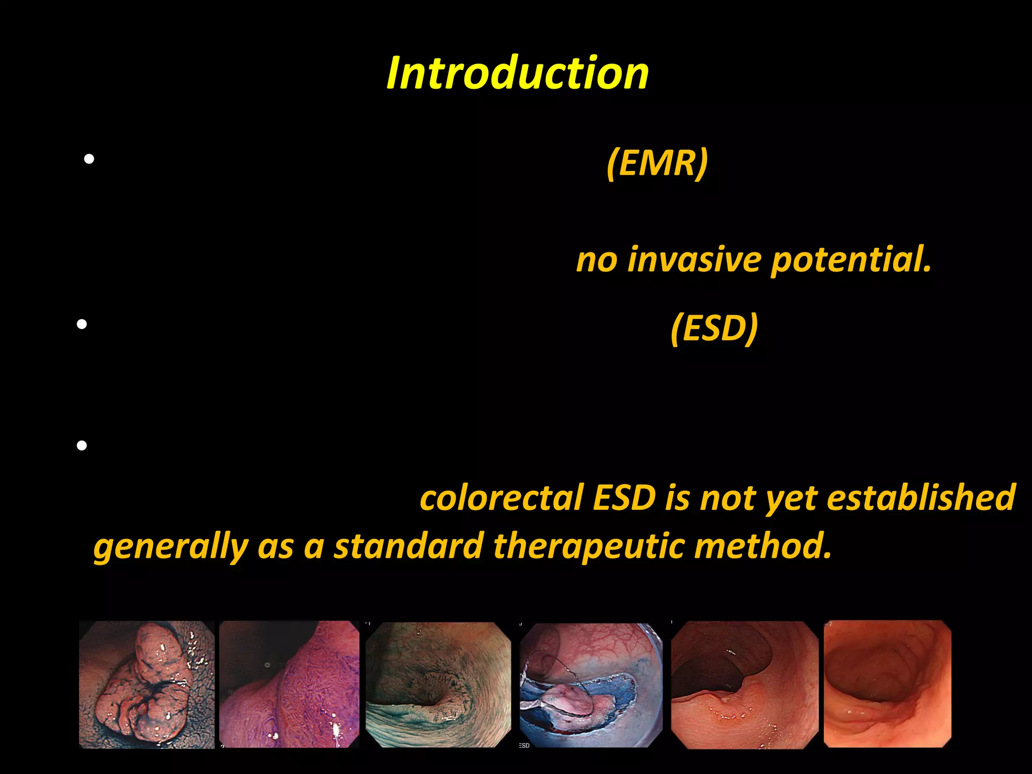 Endoscopy in Gastrointestinal Oncology - Slide 18 - T. Matsuda ...
