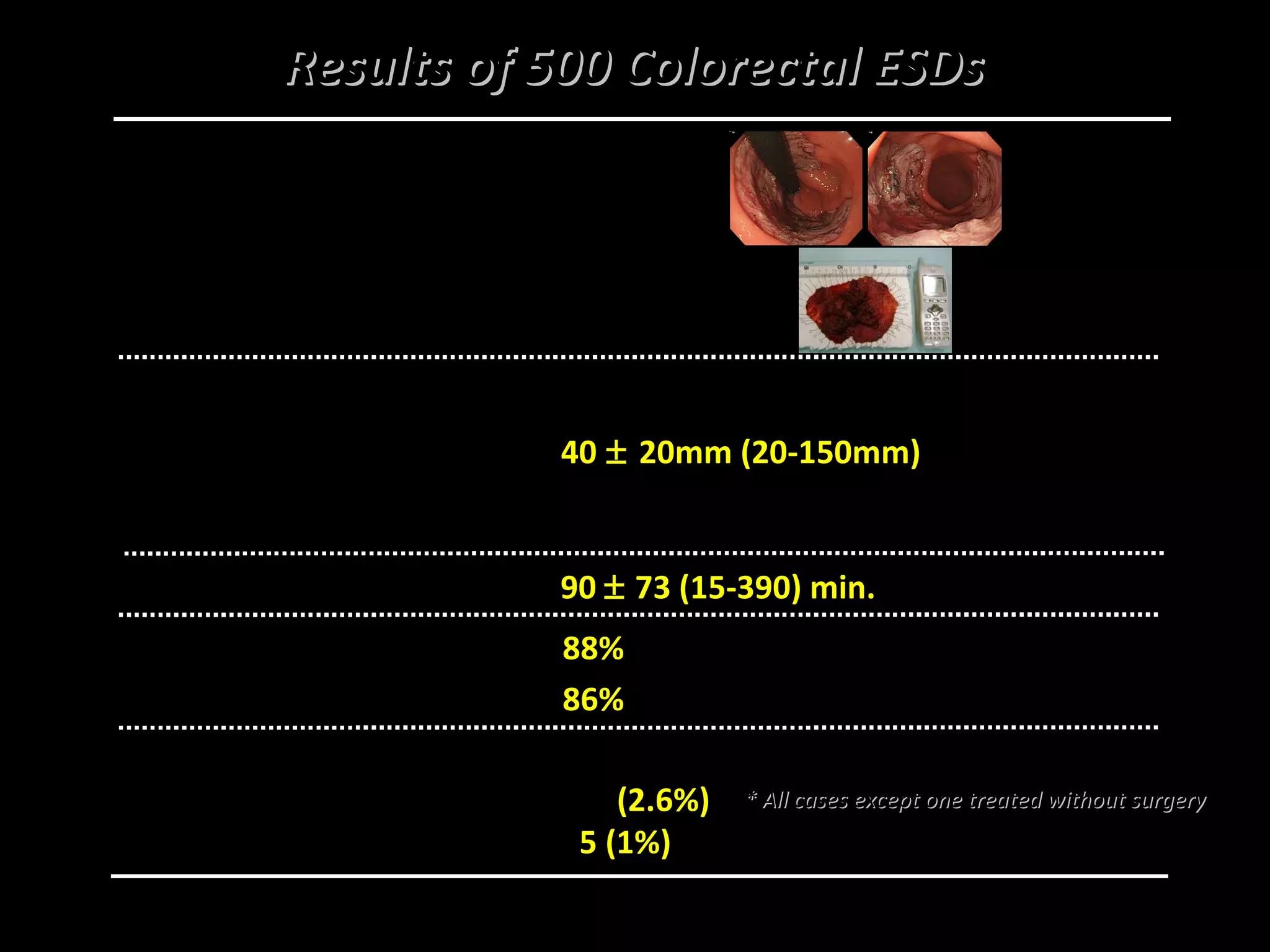 Endoscopy in Gastrointestinal Oncology - Slide 18 - T. Matsuda ...