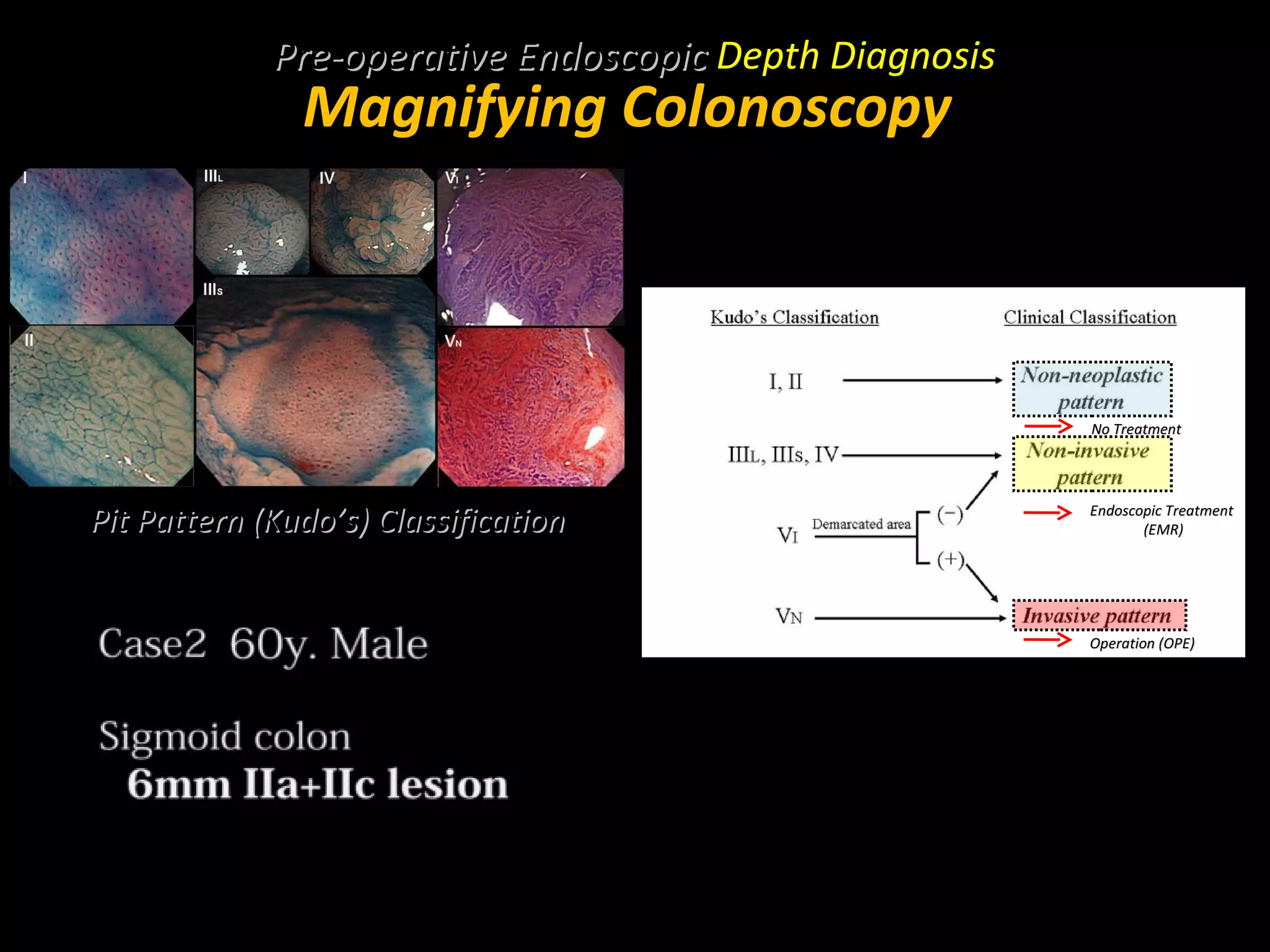 Endoscopy in Gastrointestinal Oncology - Slide 18 - T. Matsuda ...