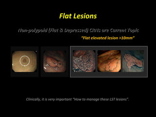 Endoscopy in Gastrointestinal Oncology - Slide 18 - T. Matsuda ...