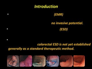 Endoscopy in Gastrointestinal Oncology - Slide 18 - T. Matsuda ...