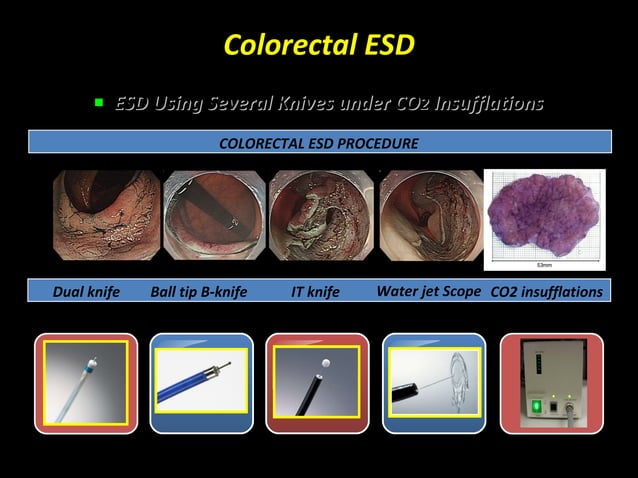 Endoscopy in Gastrointestinal Oncology - Slide 18 - T. Matsuda ...