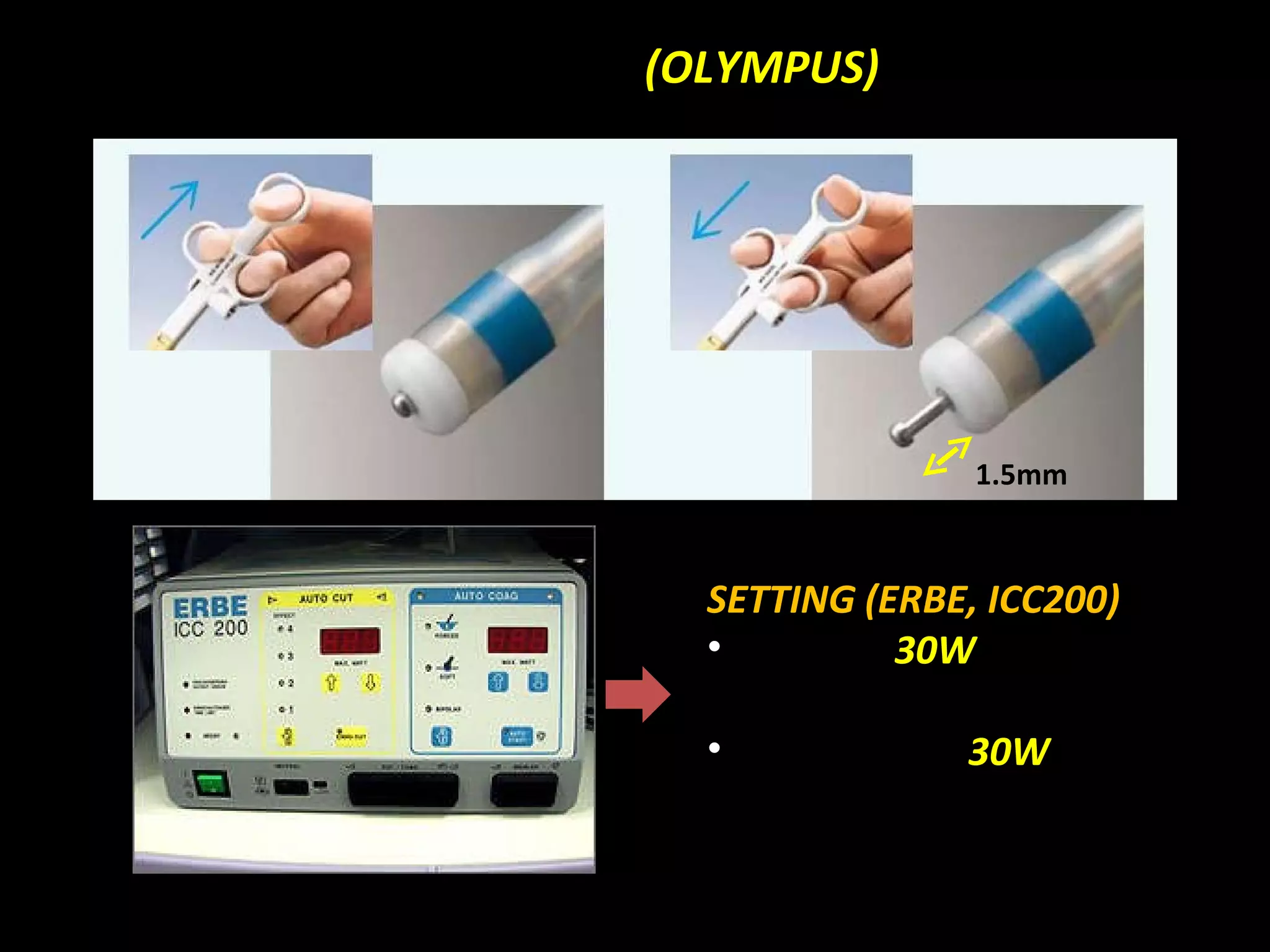 Endoscopy in Gastrointestinal Oncology - Slide 18 - T. Matsuda ...