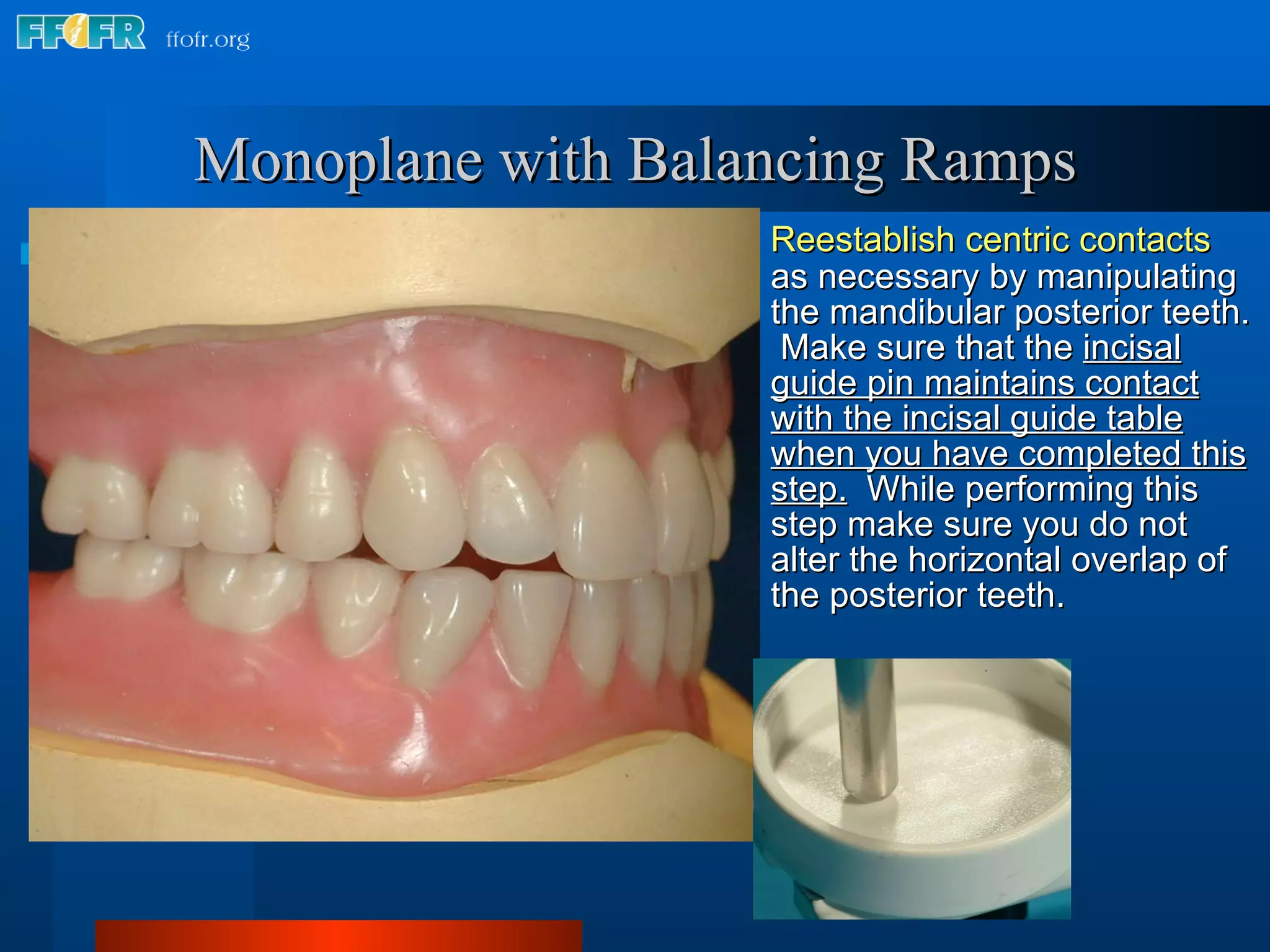 18.occlusal schemes monoplane with balancing ramps | PPT