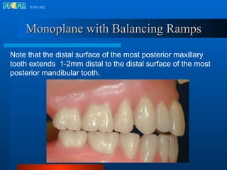 18.occlusal schemes monoplane with balancing ramps | PPT