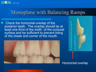 18.occlusal schemes monoplane with balancing ramps | PPT