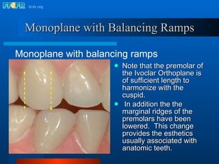 18.occlusal schemes monoplane with balancing ramps | PPT