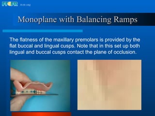 18.occlusal schemes monoplane with balancing ramps | PPT