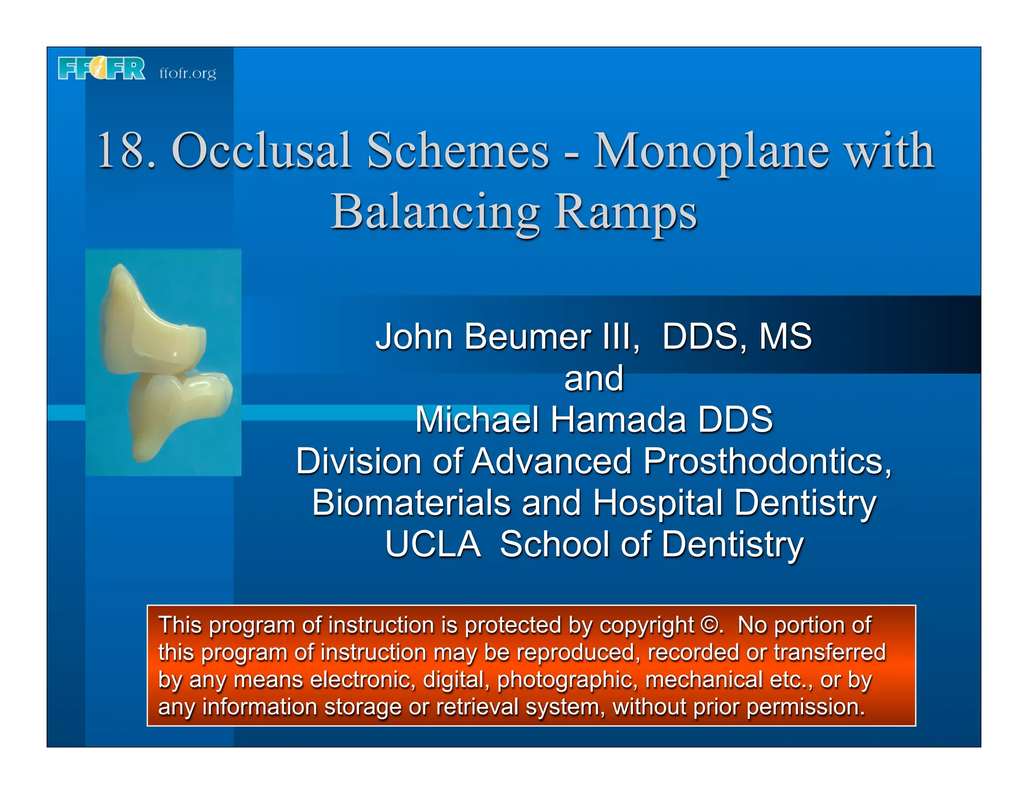 18.occlusal schemes monoplane with balancing ramps | PDF