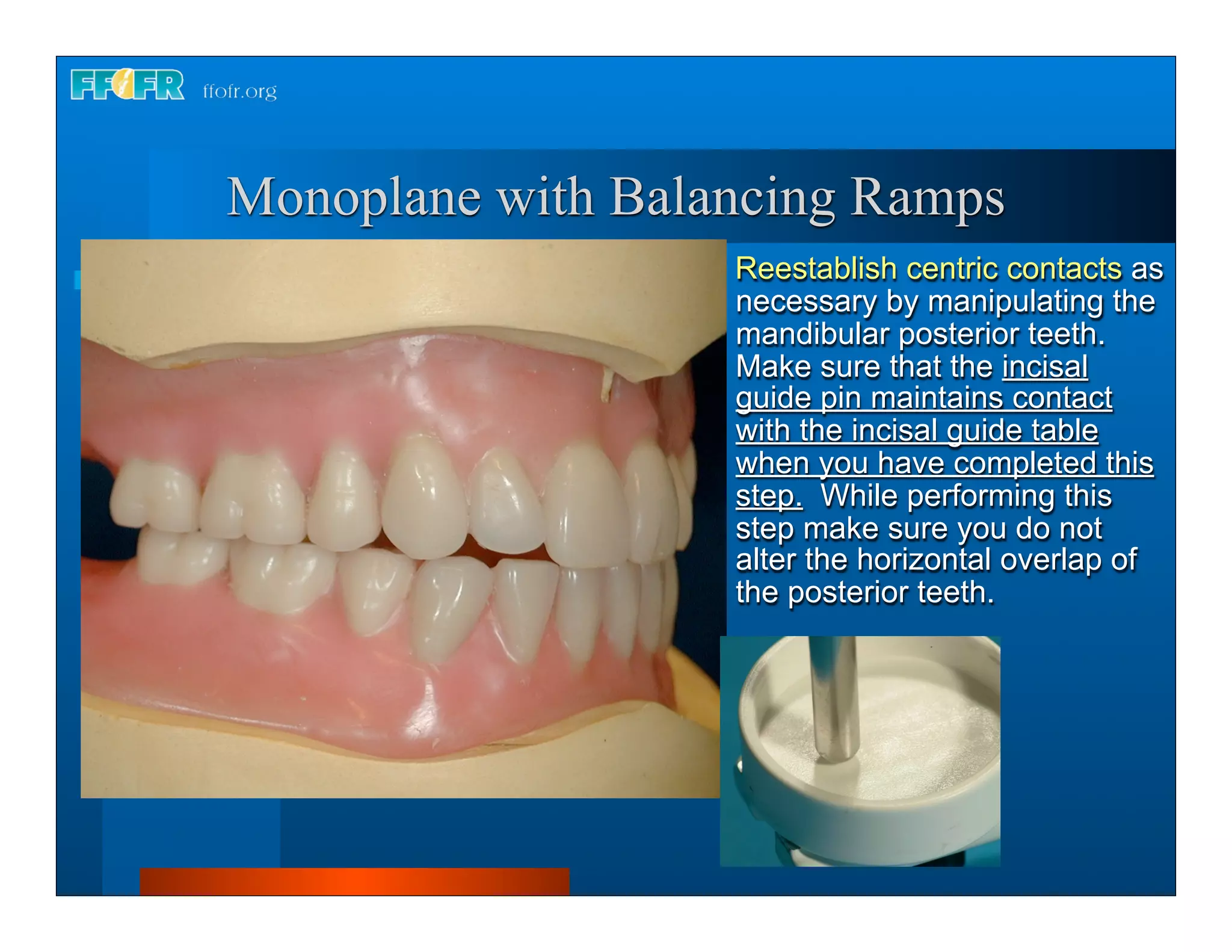 18.occlusal schemes monoplane with balancing ramps | PDF