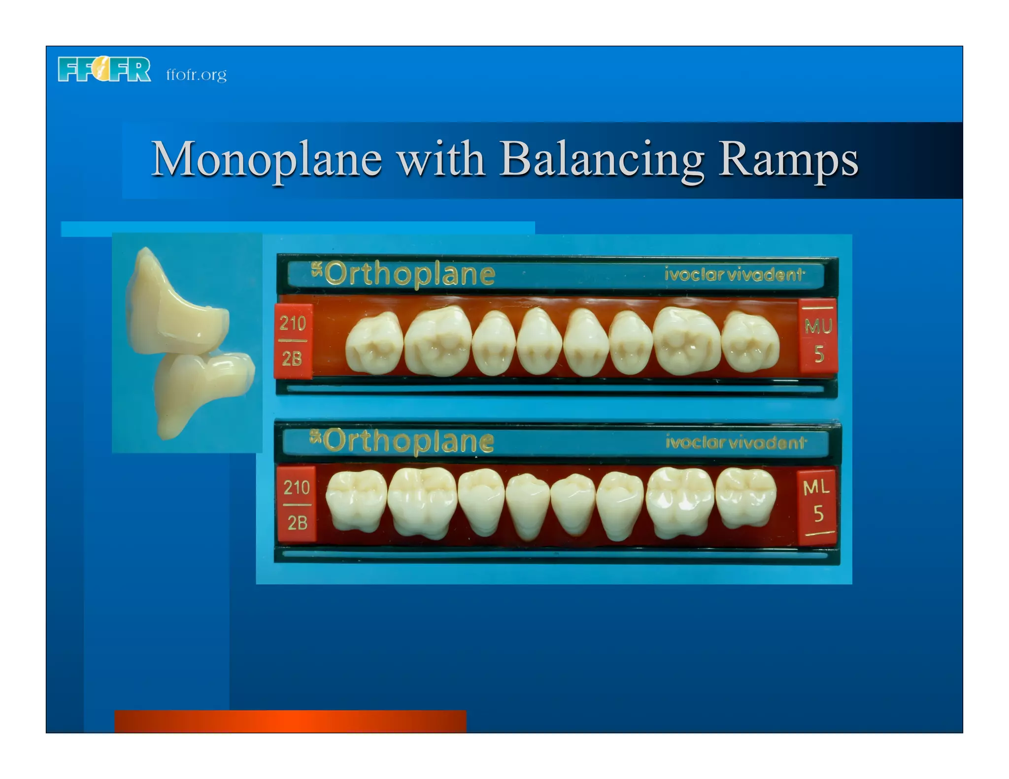 18.occlusal schemes monoplane with balancing ramps | PDF