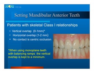 18.occlusal schemes monoplane with balancing ramps | PDF