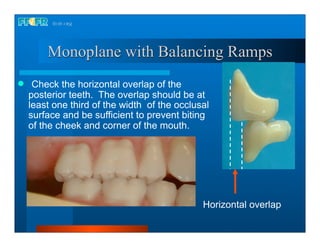 18.occlusal schemes monoplane with balancing ramps | PDF