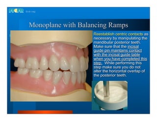 18.occlusal schemes monoplane with balancing ramps | PDF