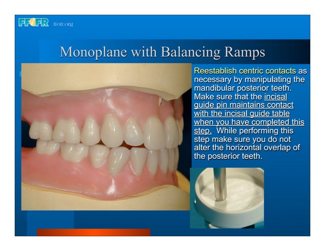 18.occlusal schemes monoplane with balancing ramps | PDF | Dental ...