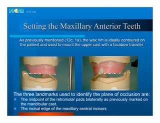 18.occlusal schemes monoplane with balancing ramps | PDF